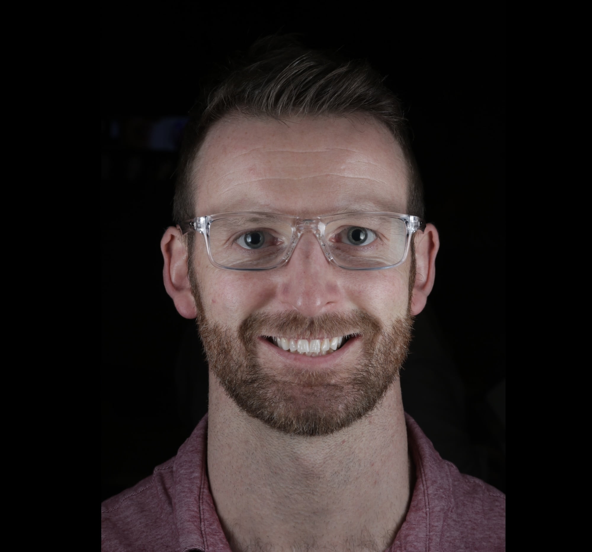 Daniel Watson | New Dental Patients | Invisalign Cheshire